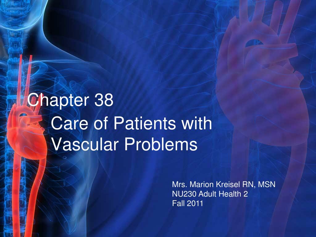 PPT - Chapter 38 PowerPoint Presentation, free download - ID:5384287