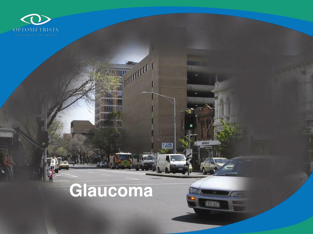 PPT - Glaucoma PowerPoint Presentation, free download - ID:5416323