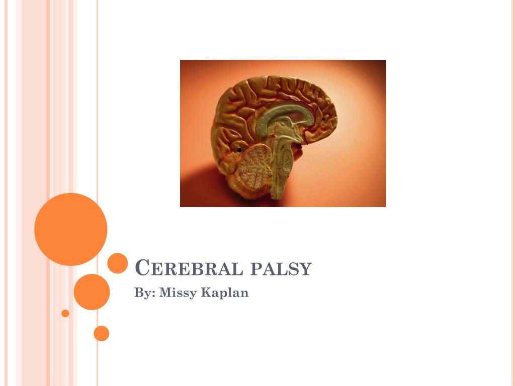 PPT - Cerebral palsy PowerPoint Presentation, free download - ID:5425658