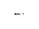 PPT - Cellulitis PowerPoint Presentation, free download - ID:813653