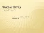 PPT - CESAREAN SECTION PowerPoint Presentation, free download - ID:4218589