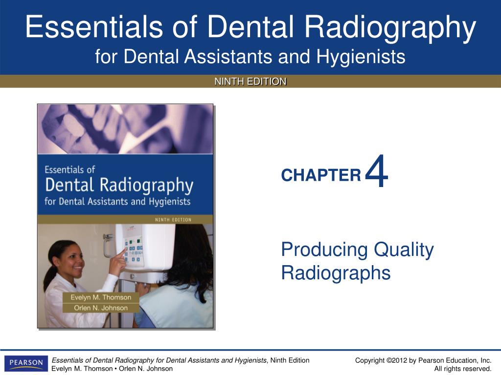 PPT - Producing Quality Radiographs PowerPoint Presentation, free ...