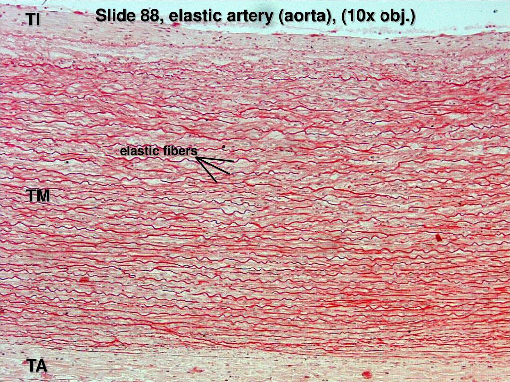 PPT - Slide 88, elastic artery (aorta), (10x obj.) PowerPoint ...