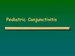 PPT - ALLERGIC CONJUNCTIVITIS PowerPoint Presentation, free download ...