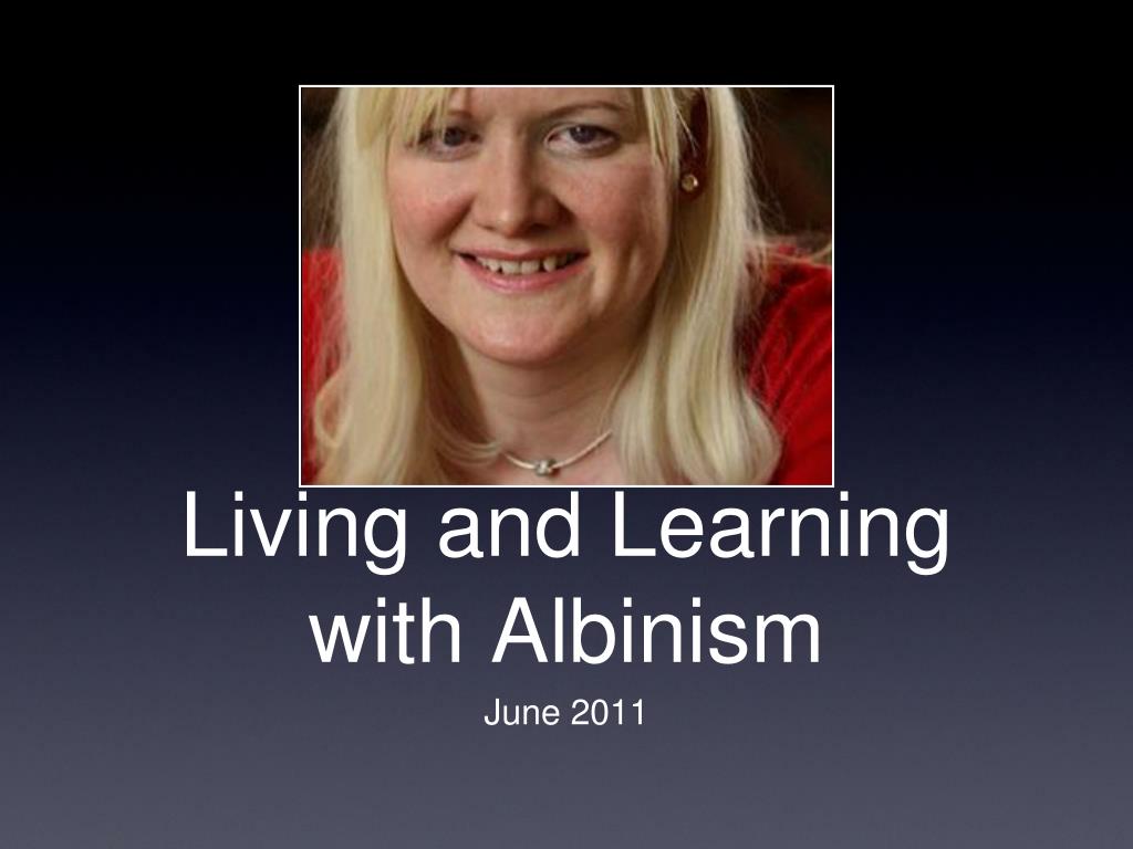 PPT - Living and Learning with Albinism PowerPoint Presentation, free ...