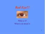 PPT - Acute Red Eye PowerPoint Presentation, free download - ID:3564132