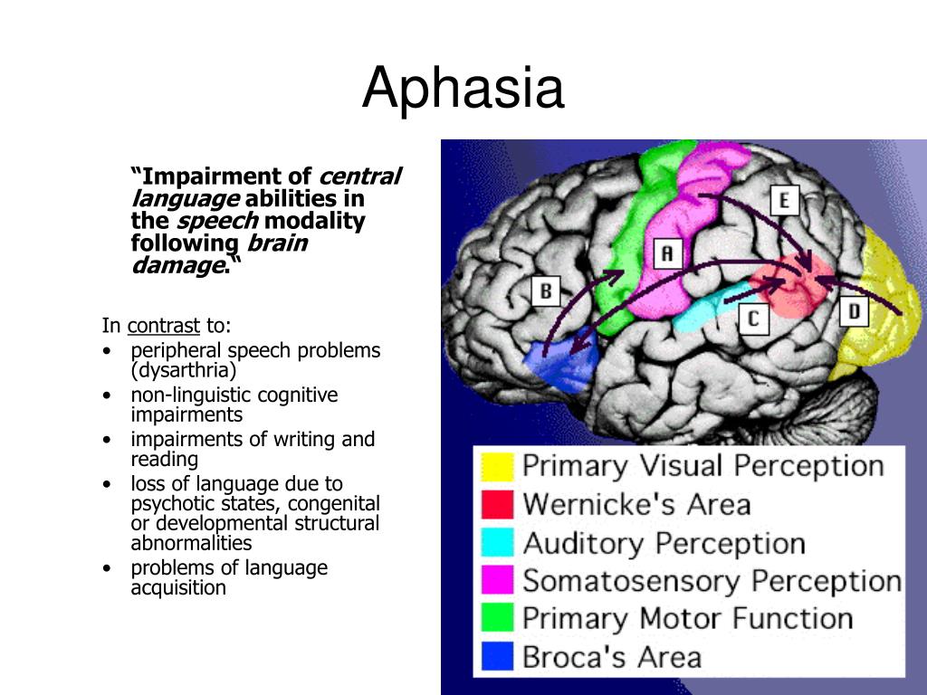 PPT - Aphasia PowerPoint Presentation, free download - ID:5681188