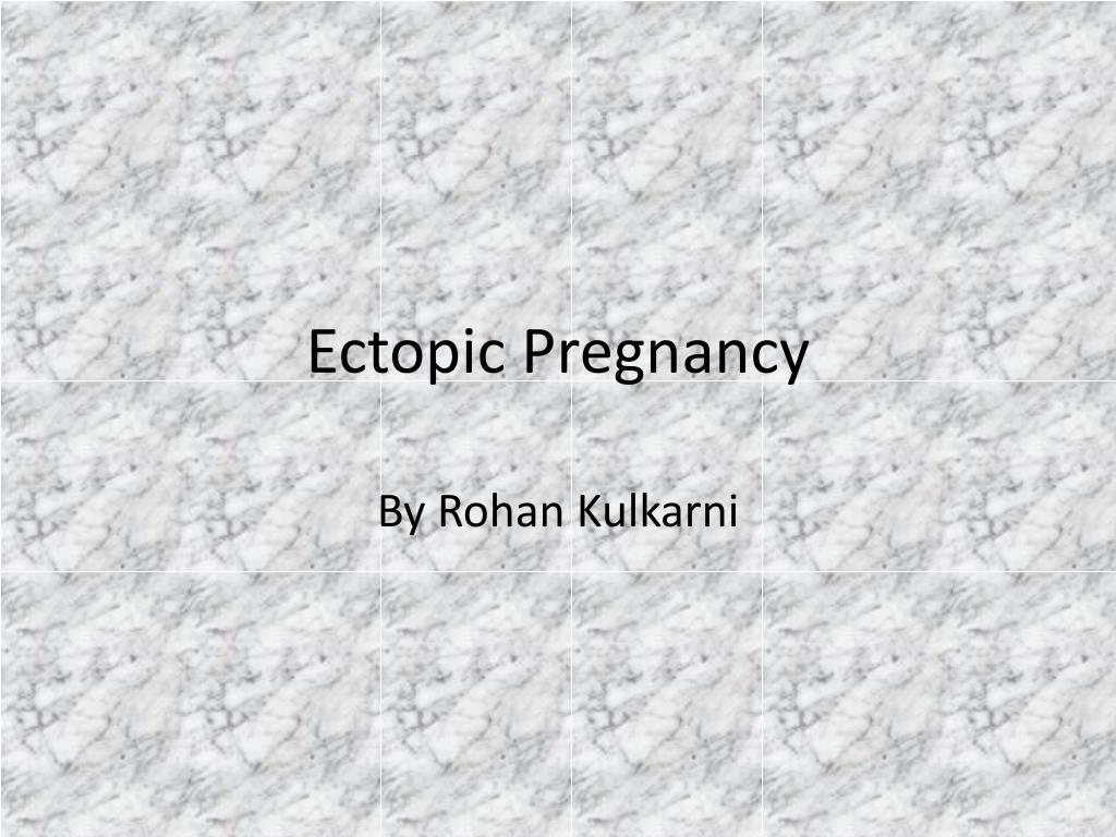 PPT - Ectopic Pregnancy PowerPoint Presentation, free download - ID:5690240