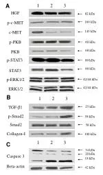 PPT - PKB PowerPoint Presentation, free download - ID:3284506