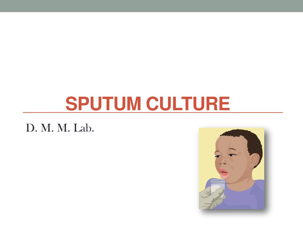 PPT - SPUTUM culture PowerPoint Presentation, free download - ID:5731153