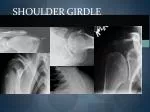 PPT - Shoulder Girdle PowerPoint Presentation, free download - ID:753209