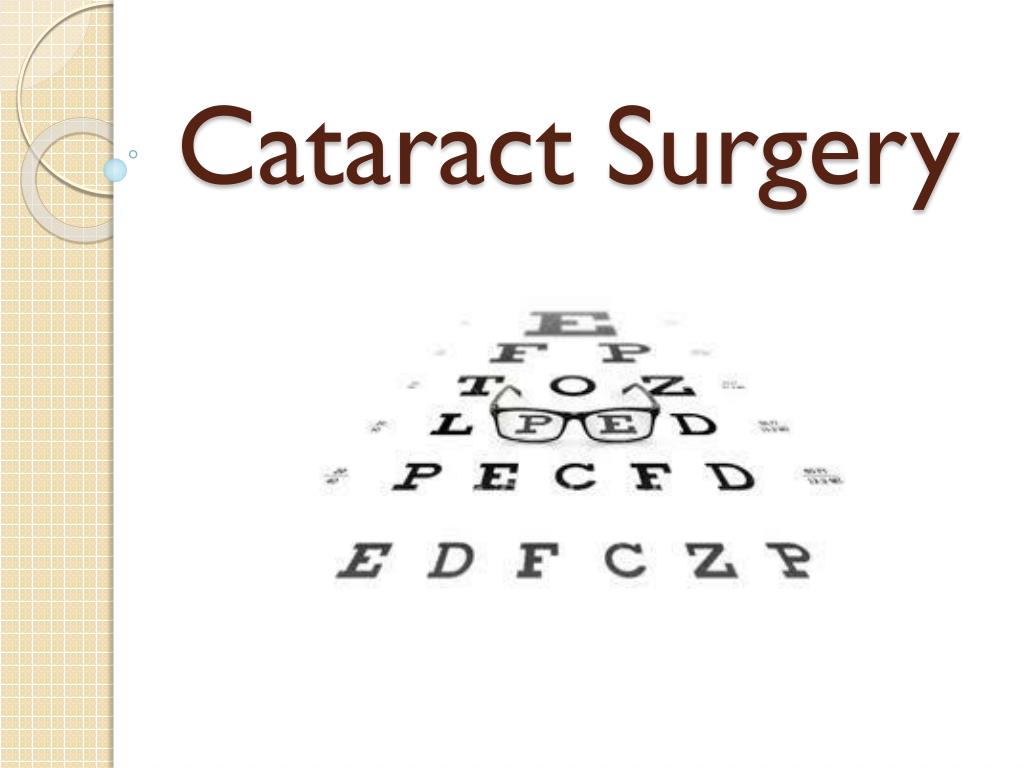 PPT - Cataract Surgery PowerPoint Presentation, free download - ID:5742289