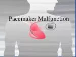 PPT - ECG in Pacemaker Malfunction PowerPoint Presentation, free ...