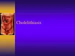 PPT - CASE PRESENTATION ON CHOLELITHIASIS PowerPoint Presentation, free ...