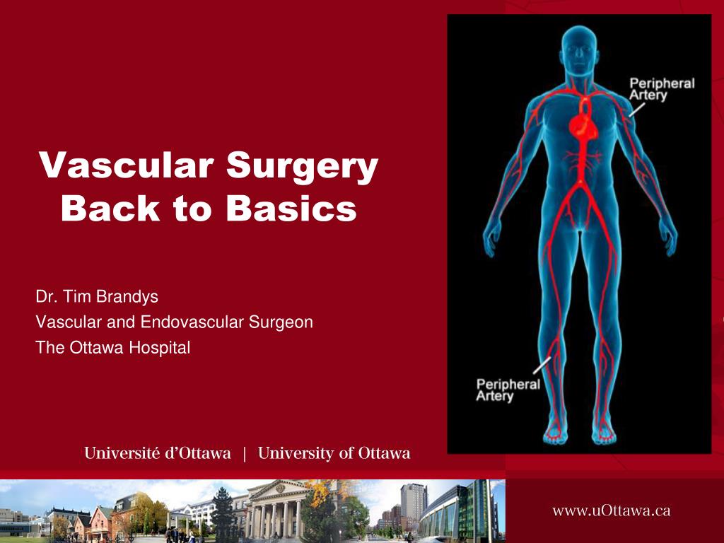 PPT - Vascular Surgery Back to Basics PowerPoint Presentation, free ...