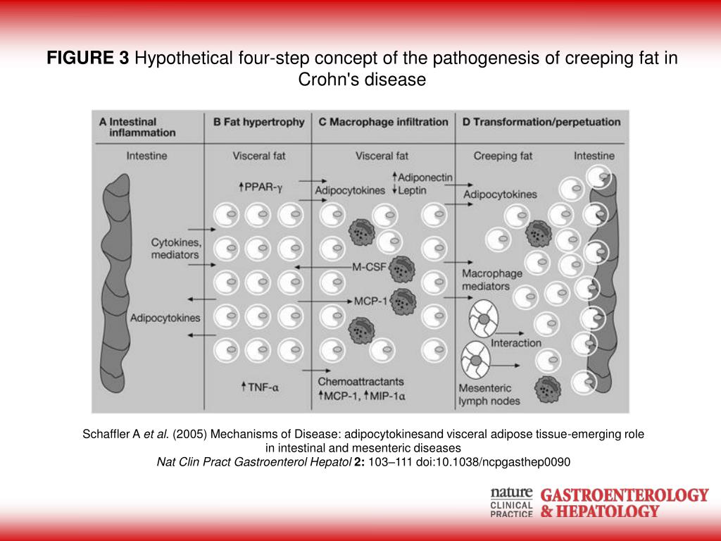 PPT - FIGURE 3 Hypothetical four-step concept of the pathogenesis of ...