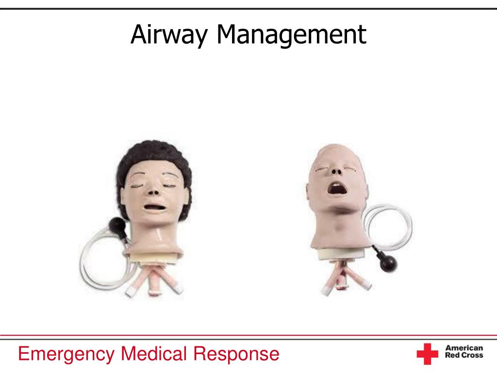 PPT - Airway Management PowerPoint Presentation, free download - ID:5921479