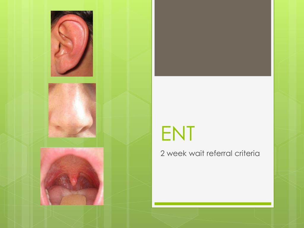 PPT - ENT PowerPoint Presentation, free download - ID:6004115