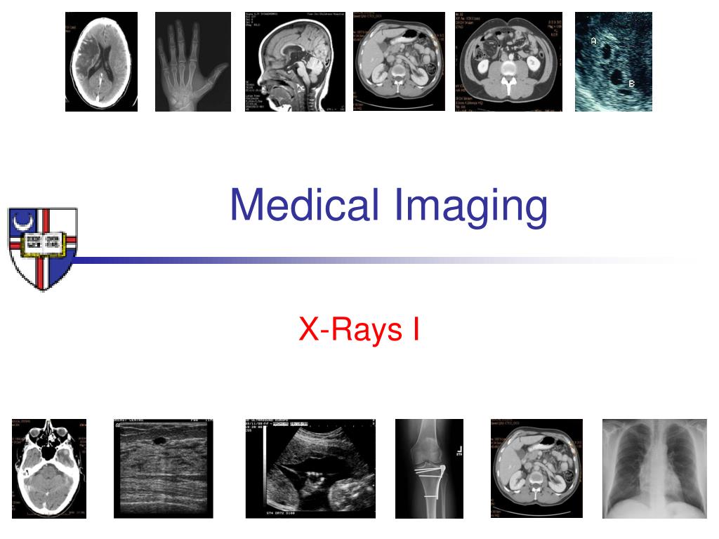 PPT - Medical Imaging PowerPoint Presentation, free download - ID:6043036