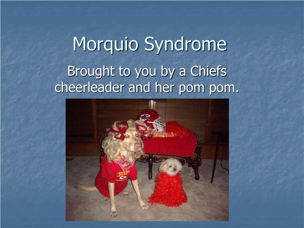 PPT - Morquio Syndrome PowerPoint Presentation, free download - ID:6084803