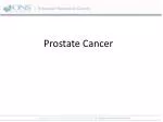 PPT - Prostate cancer screening PowerPoint Presentation, free download ...