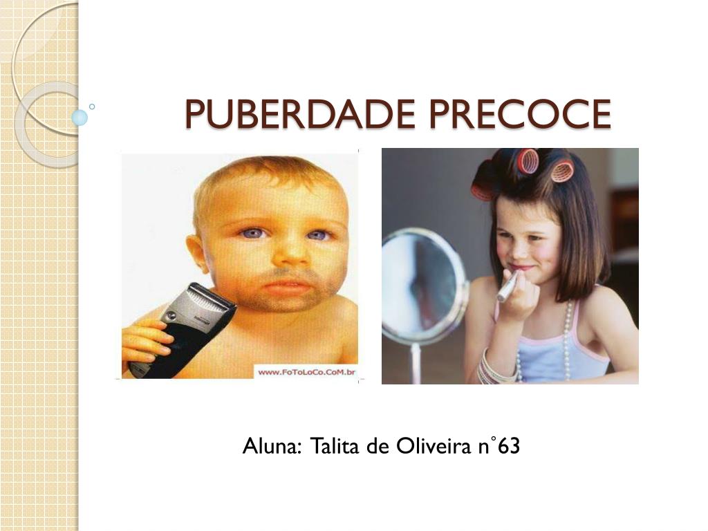 PPT - PUBERDADE PRECOCE PowerPoint Presentation, free download - ID:6155315