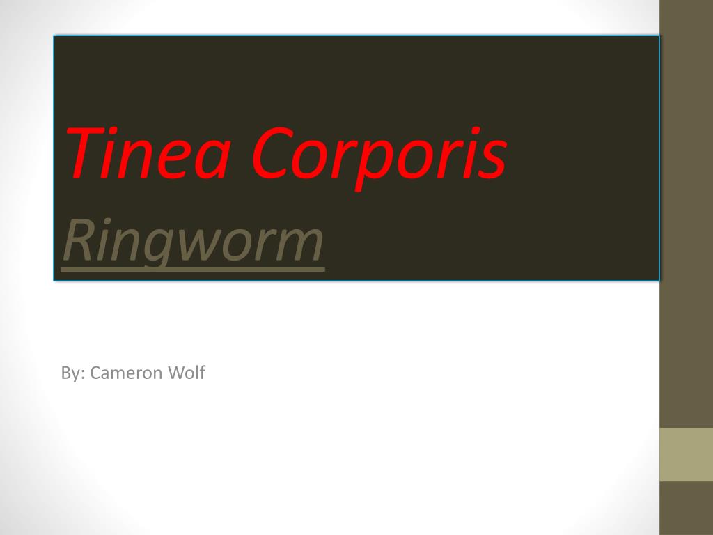 PPT - Tinea Corporis Ringworm PowerPoint Presentation, free download ...