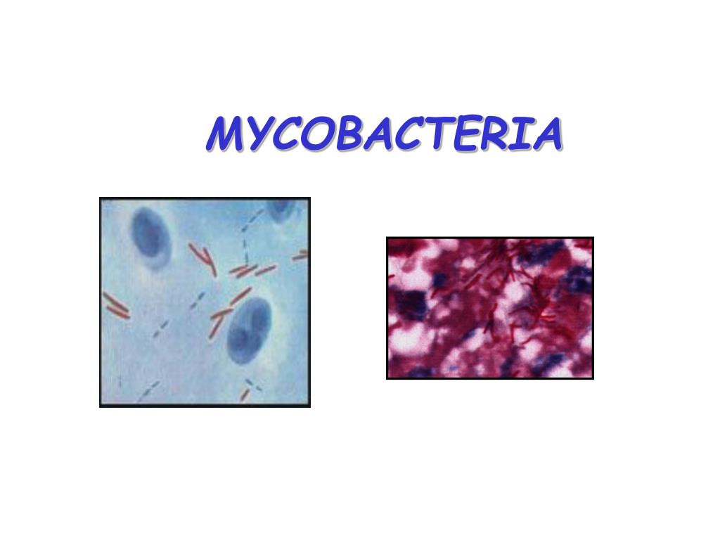 PPT - MYCOBACTERIA PowerPoint Presentation, free download - ID:6260722