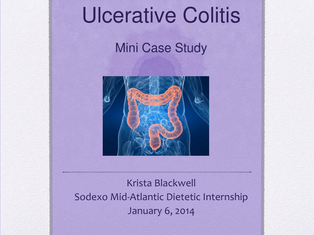 PPT - Ulcerative Colitis Mini Case Study PowerPoint Presentation, free ...