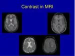 PPT - MRI Contrast Agents PowerPoint Presentation, free download - ID ...