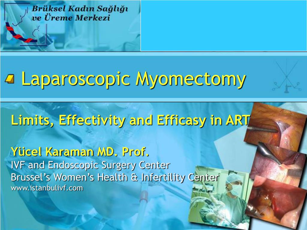 PPT - Laparoscopic Myomectomy PowerPoint Presentation, free download ...