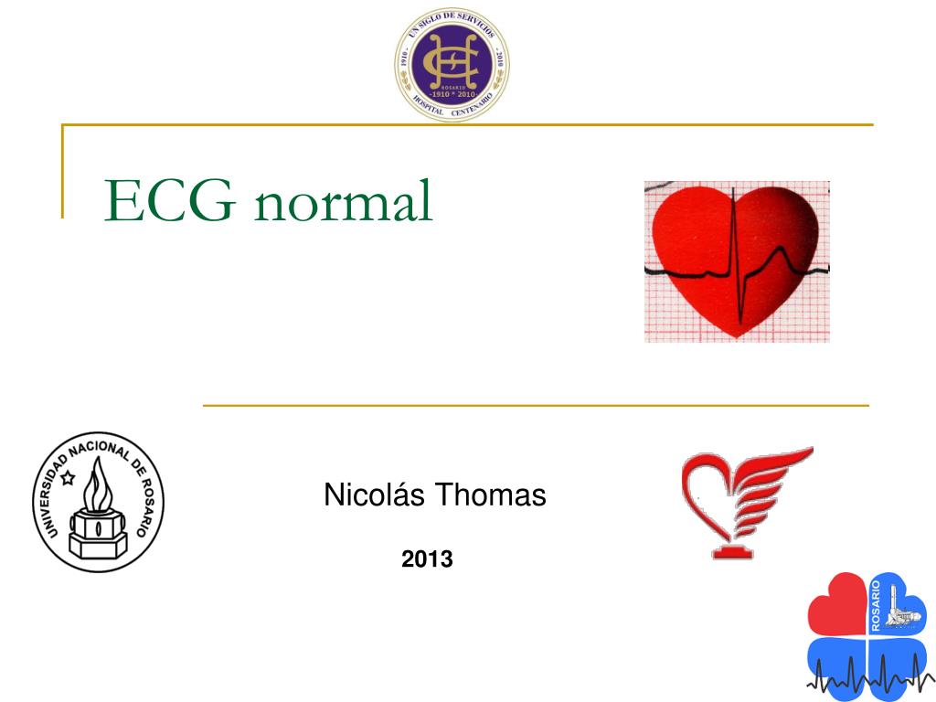 PPT - ECG normal PowerPoint Presentation, free download - ID:6329506