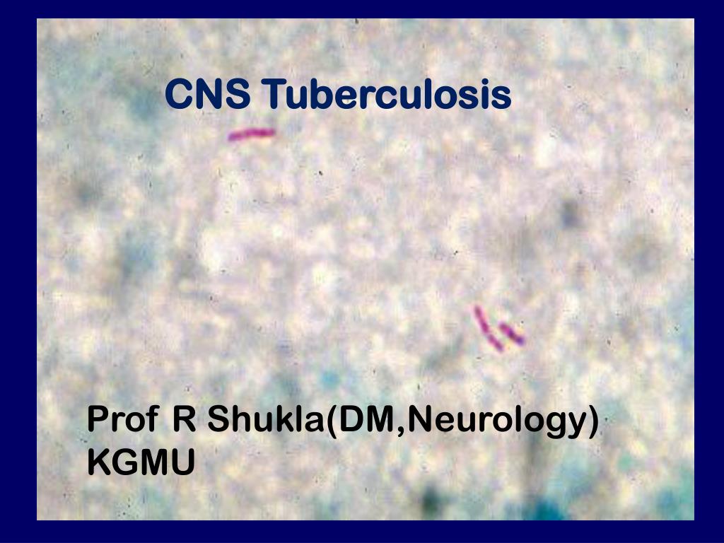 PPT - CNS Tuberculosis PowerPoint Presentation, free download - ID:6336519