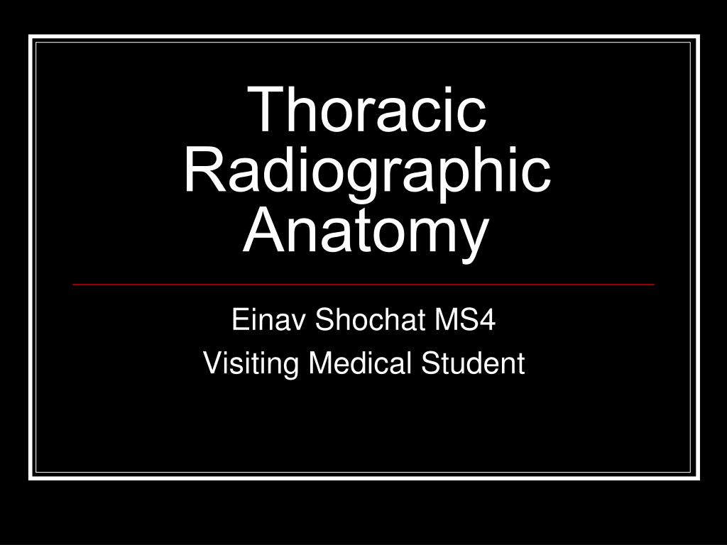 PPT - Thoracic Radiographic Anatomy PowerPoint Presentation, free ...