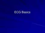 PPT - ECG Basics PowerPoint Presentation, free download - ID:9366489