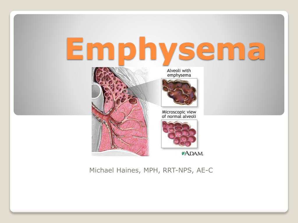 PPT - Emphysema PowerPoint Presentation, free download - ID:6407231