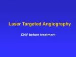 PPT - Angiography PowerPoint Presentation, free download - ID:5177574