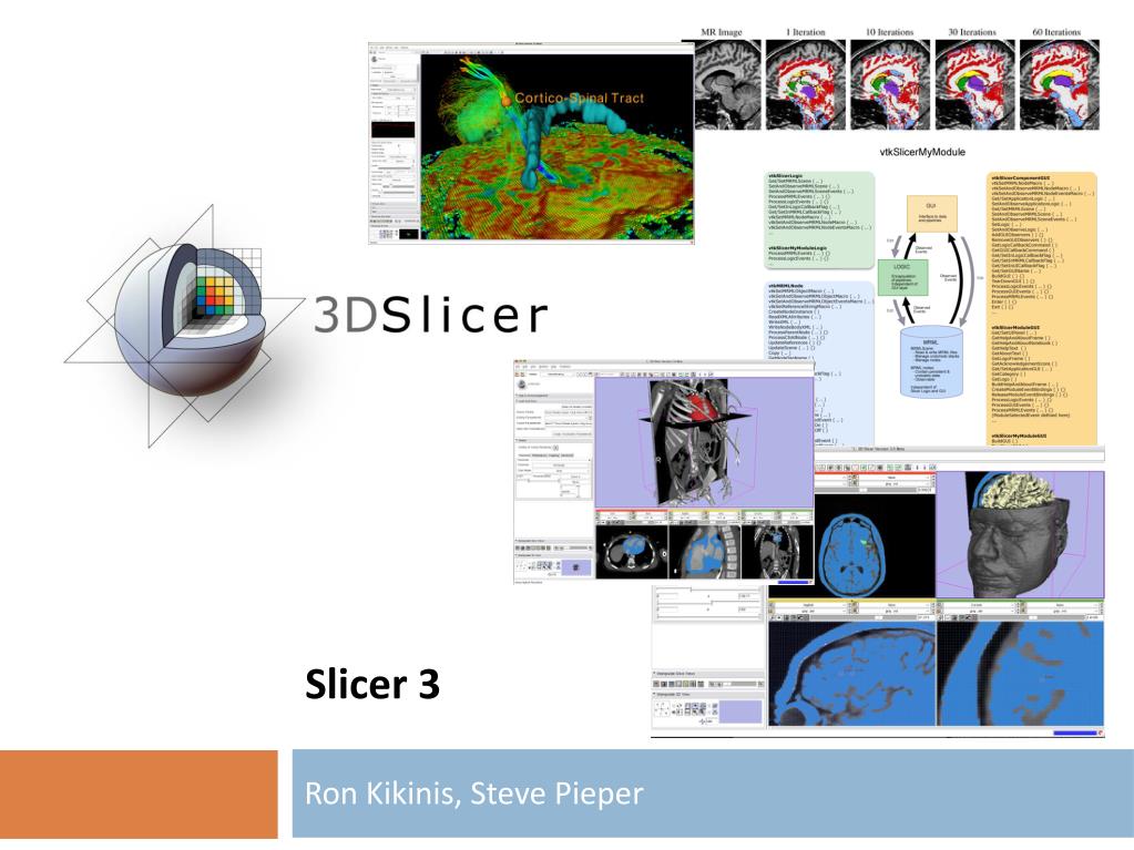 PPT - Slicer 3 PowerPoint Presentation, free download - ID:6577262