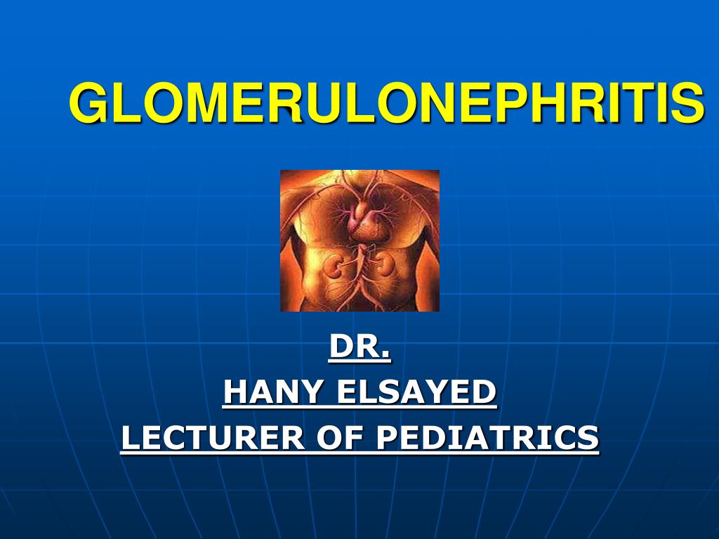 PPT - GLOMERULONEPHRITIS PowerPoint Presentation, free download - ID:6587365