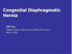 PPT - Congenital diaphragmatic hernia PowerPoint Presentation, free ...