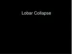 PPT - Lobar Collapse PowerPoint Presentation, free download - ID:156073