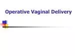 PPT - OPERATIVE DELIVERY PowerPoint Presentation, free download - ID ...