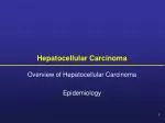 PPT - Hepatocellular Carcinoma PowerPoint Presentation - ID:2091301