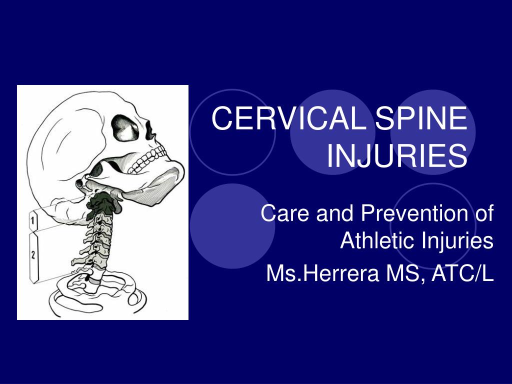 PPT - CERVICAL SPINE INJURIES PowerPoint Presentation, free download ...