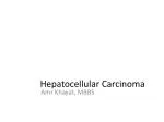 PPT - Hepatocellular Carcinoma PowerPoint Presentation - ID:2091301