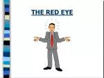 PPT - The Differential Diagnosis of The Red Eye PowerPoint Presentation ...