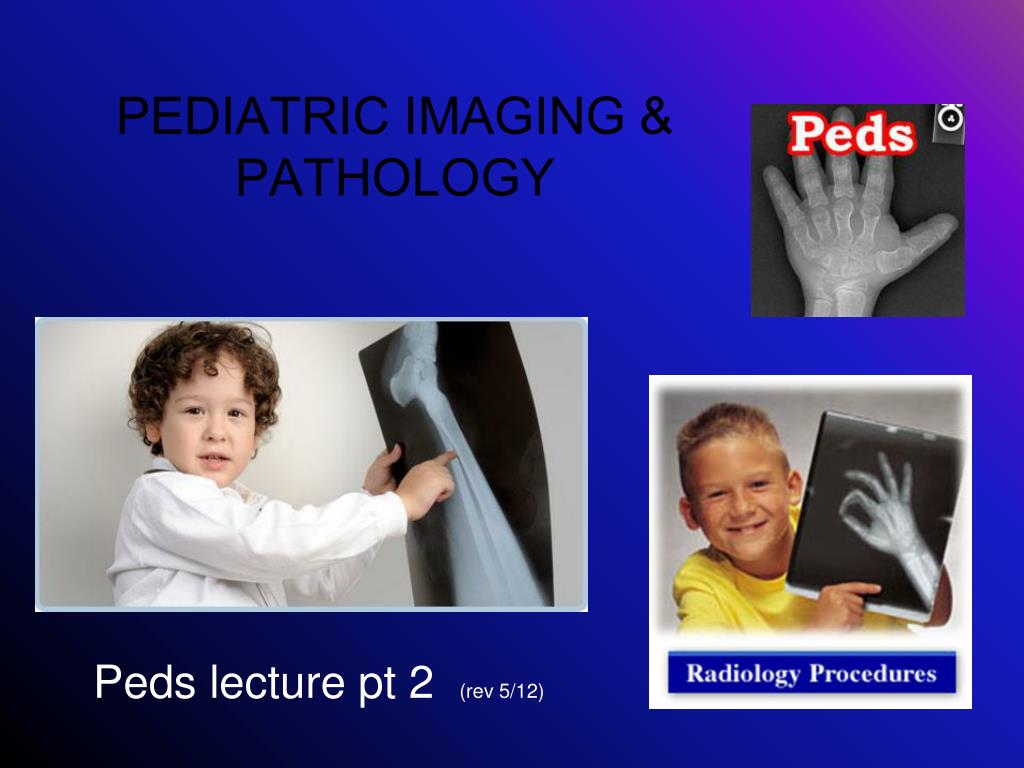 PPT - Peds lecture pt 2 (rev 5/12) PowerPoint Presentation, free ...