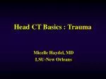PPT - Introduction to Head CT Imaging PowerPoint Presentation, free ...