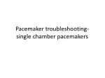PPT - Temporary Pacemakers PowerPoint Presentation, free download - ID ...