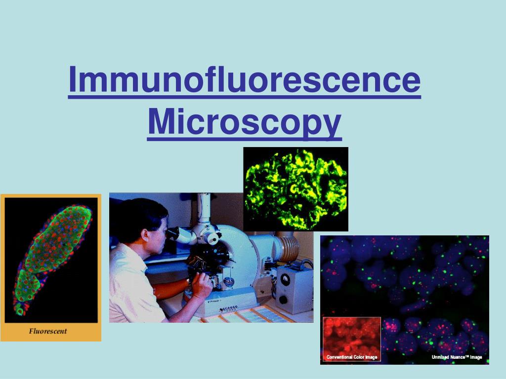 PPT - Immunofluorescence Microscopy PowerPoint Presentation, free ...